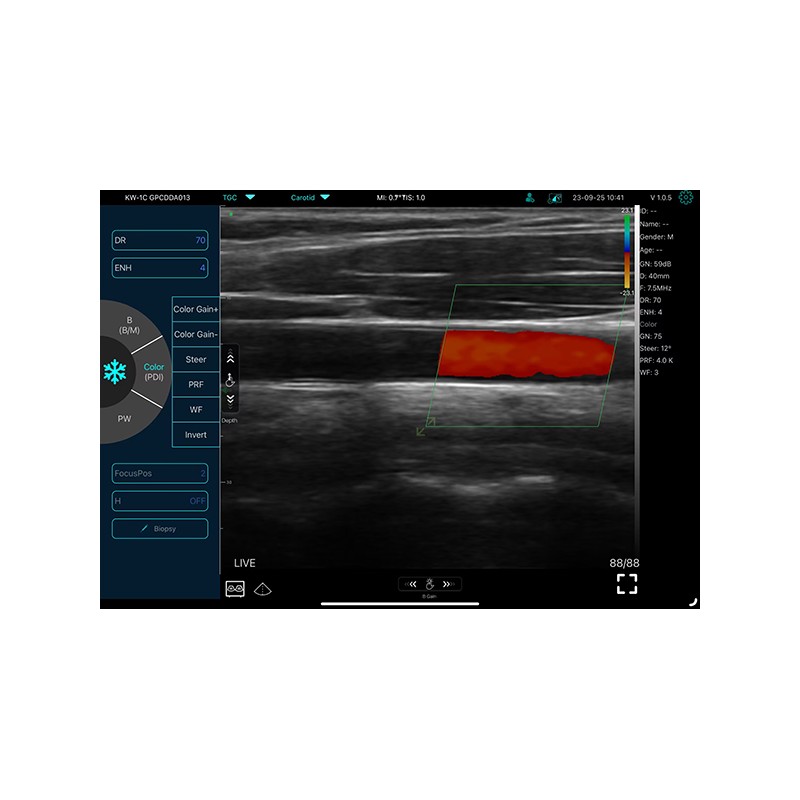 C10CS Color Superfical Ultrasound HD Linear Probe