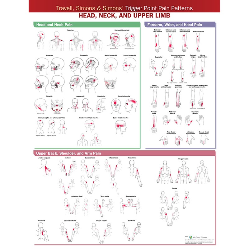 Travell & Simons Trigger Point Chart